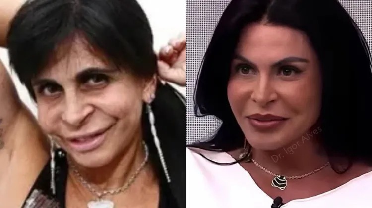 Gretchen surpreende fãs com “novo rosto” e causa alvoroço nas redes ...