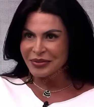 Gretchen surpreende fãs com “novo rosto” e causa alvoroço nas redes ...
