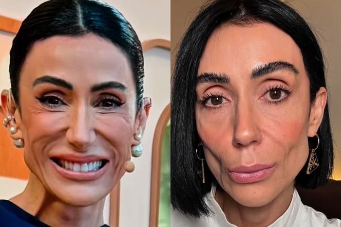 "Piorou minha flacidez": Michelle Barros fala sobre erro estético e ...