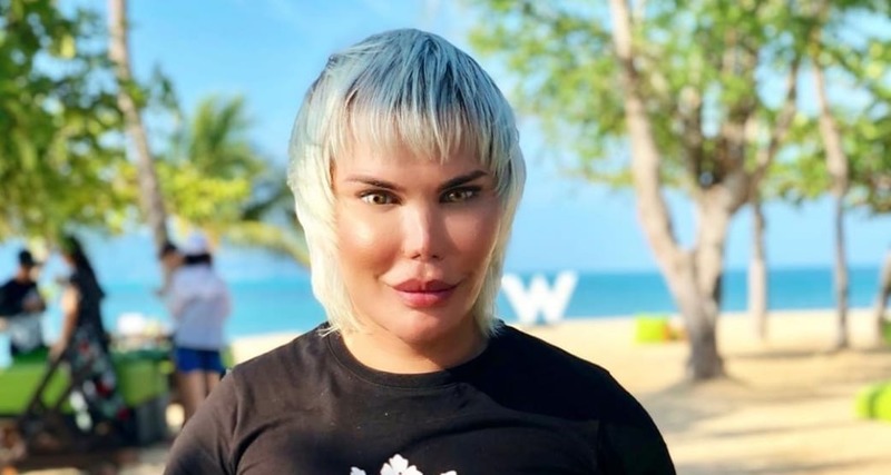 Ken Humano diz que está com medo de perder o nariz após 11ª cirurgia plástica