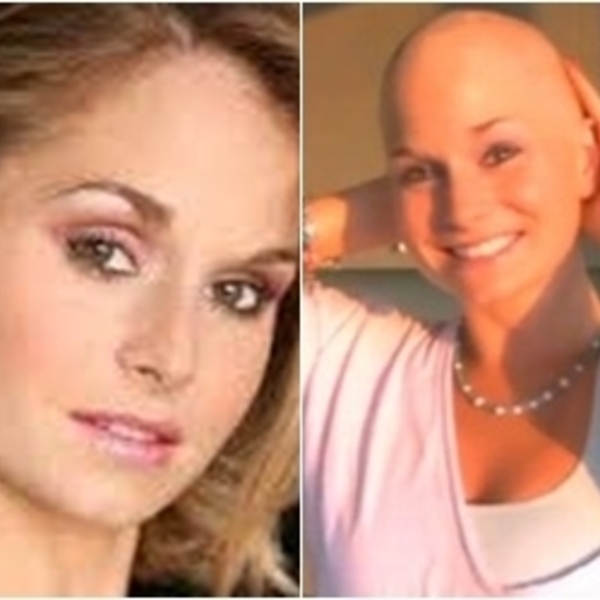 Atriz de Hollywood revela que é careca: 'Meu cabelo definia minha beleza'