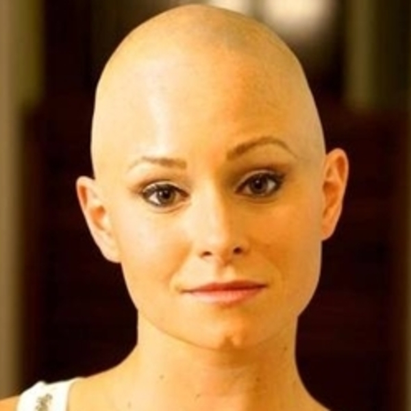 Atriz de Hollywood revela que é careca: 'Meu cabelo definia minha beleza'