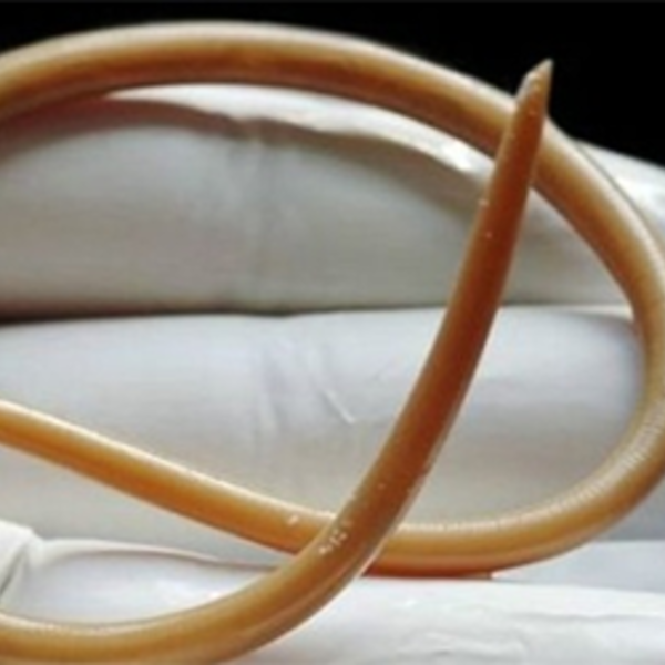 Sem nojo! Lombriga aumenta fertilidade das mulheres, diz estudo