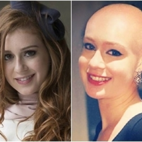 Personagem de Nicole ficará careca e atriz vai raspar o cabelo em 'Amor'